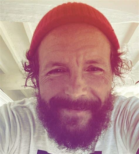 Jovanotti Operato A Santo Domingo Dolore Fortissimo Ecco Come Sta