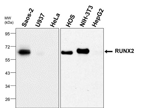 Runx2 Monoclonal Antibody Irr003 草稿 Ireal Biotechnology Inc