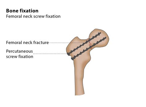 Cirse Innovation Education Intervention