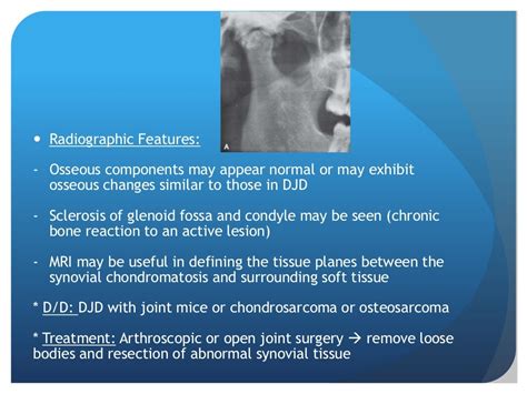 Radiographic Imaging Of Tmj