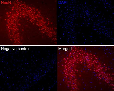 Ifluor™ 594 Conjugated Neun Recombinant Rabbit Monoclonal Antibody Sr