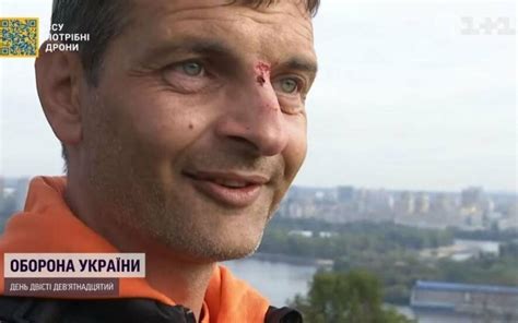 Людина яка втратила 4 сантиметри кістки але не втратила почуття гумору звільнений з полону