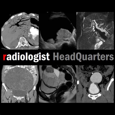 Case Of The Week Testicular Epidermoid Cyst Ultrasound Radiology