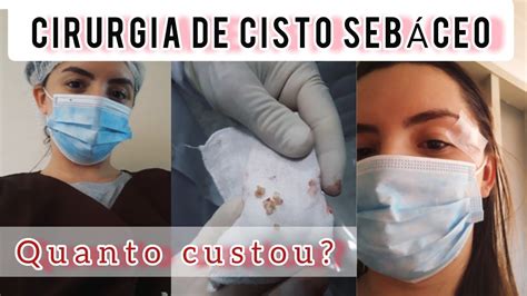 Minha cirurgia do cisto sebáceo o pós operatório YouTube