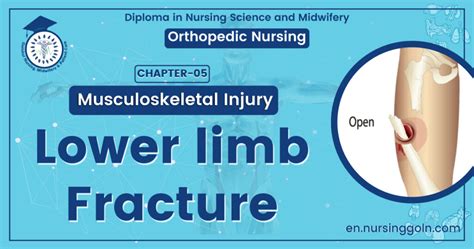 Lower Limb Fracture Chapter 5 Orthopedic Nursing Nursing