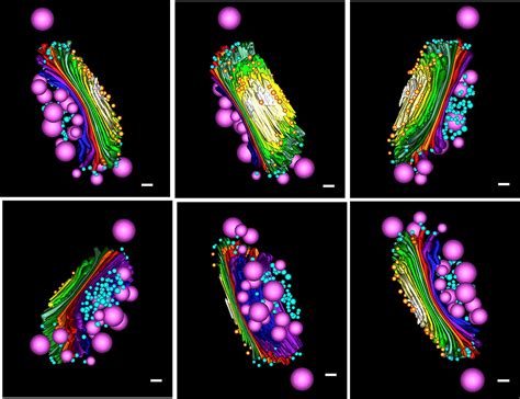 Electron Tomography