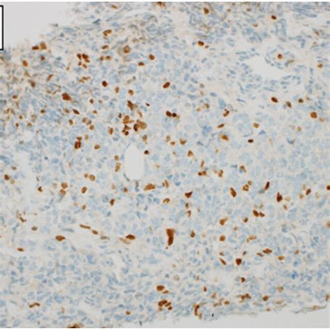 Histopathological Examinations A Hematoxylin And Eosin Staining