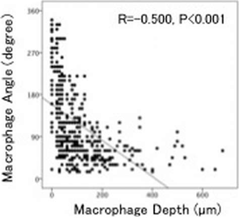 Macrophage Depth And Angle Conclusions In Culprit Vessel Of Stemi Oct