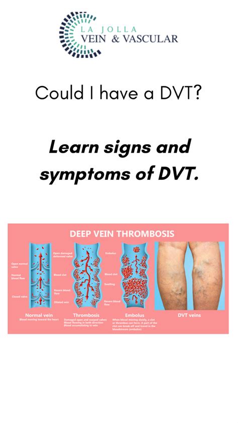 Could I Have A Dvt Learn Signs And Symptoms Of Deep Vein Thrombosis