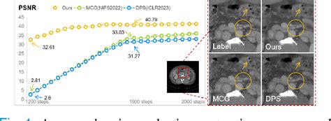 Data Iterative Optimization Score Model For Stable Ultra Sparse View Ct