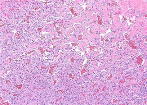 General Pathology Quarter 1 Midterm Information Flashcards Quizlet