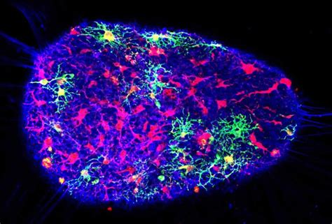 3d Mini Brains Accelerate Research For Repairing Brain Function