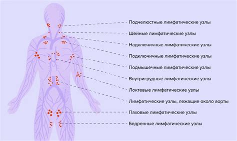 Лимфоузлы на теле человека 55 картинок