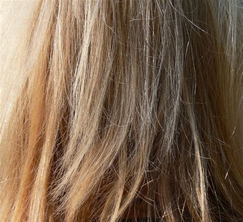 How To Stop Burning Sensation On Scalp Relief Solutions That Work