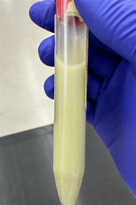 Dilute Urine Color