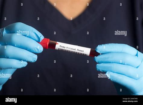 Comprehensive Metabolic Panel A Cmp Blood Test Is A Panel Of 14 Tests Comprehensive Metabolic Panel A Cmp Blood Test Is A Panel Of 14 Tests