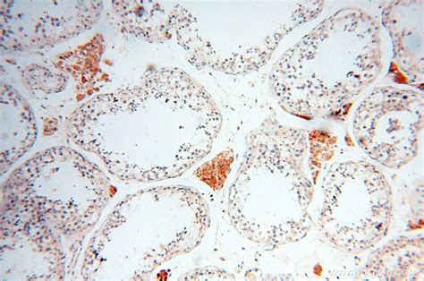 Inpp5e Antibody 17797 1 Ap Proteintech