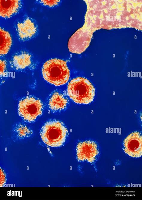 Human Herpes Virus Type 6 Coloured Transmission Electron Micrograph Of