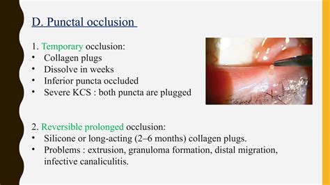 Dry Eye Causes Aetiology Pathogenesis Treatmentpptx