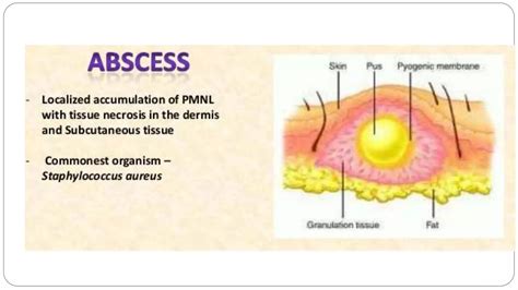 13 Surgical Infections Of The Skin And Subcutaneous Tissues Pptx