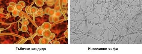 При остеопороза и гъбички в тялото, за детоксикация Медбио+ Магнебор ...