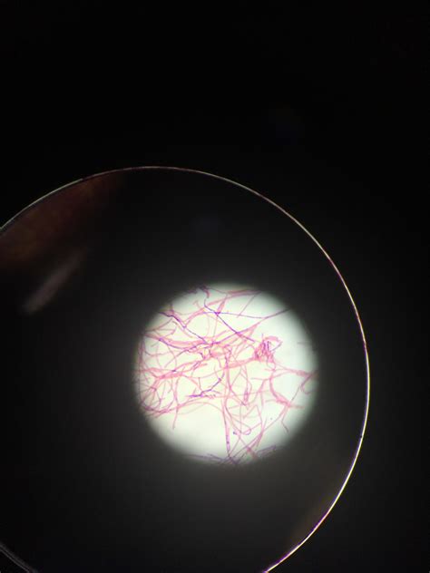 Can Anyone Help Me Identify This Bacteria Its For An Assignment But It Doesnt Appear To Be