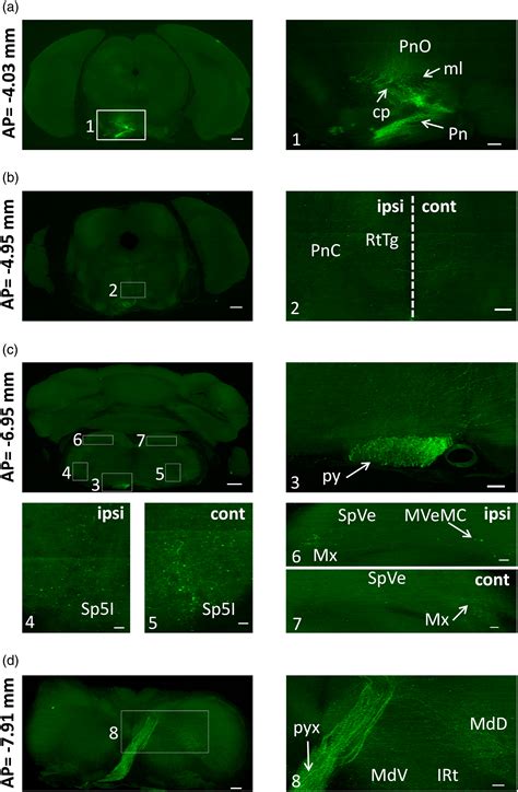 Whole Brain Mapping Of Efferent Projections Of The Anterior Cingulate
