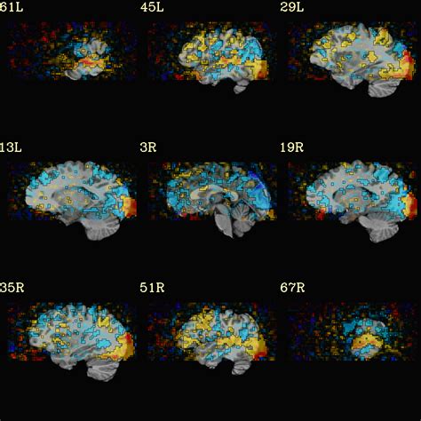 12 12 2 Using Chauffeur Afni — Afni Suma And Fatcat V25 2 05