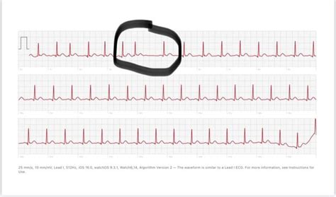 Is This Pvc Or Pac R Pvcs