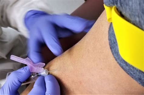 Peripheral Nerve Blocks Comprehensive Md Comprehensive Md