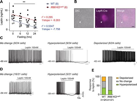 Primary Cilia Regulate Adaptive Responses To Fasting Metabolism