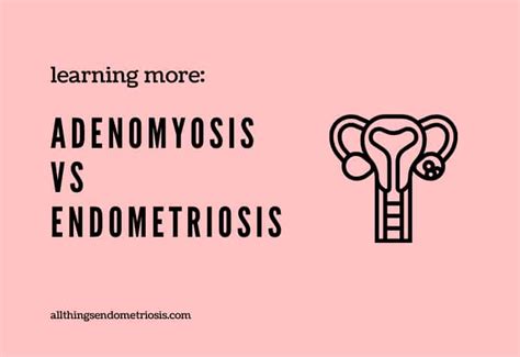Adenomyosis Vs Endometriosis All Things Endometriosis And More