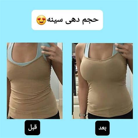 آوخ هستم مشاور سلامت و زیبایی On Instagram حجم دهی سینه و باسن با