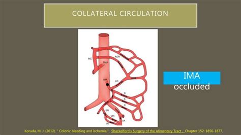 12 3 61 Colonic Ischemia In Evar And Open Repair Aaa Ppt