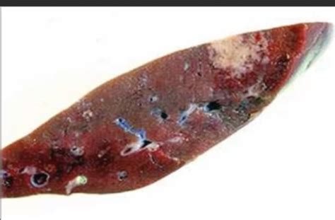 Hematopoietic And Hemolymphatic Disorders Flashcards Quizlet