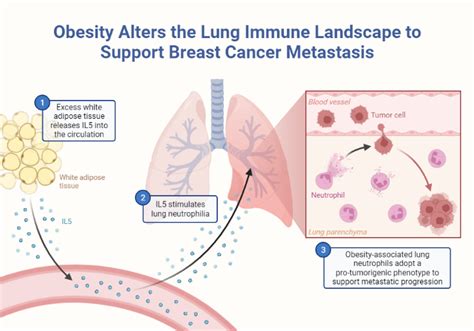 Obesity Alters The Lung Immune Landscape To Support Breast Cancer