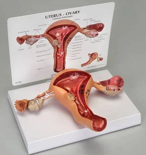 Pvc Female Reproductive System Model At ₹ 1000piece In Ambala Id