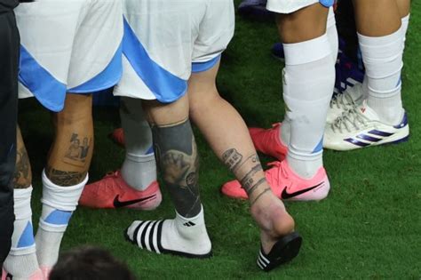 Messi Di Final Copa America Cedera Menangis Di Bangku Cadangan