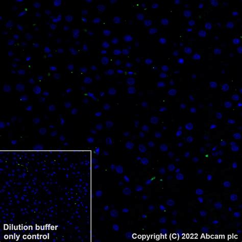 Alpha 1 Fetoprotein重组抗体 Epr26548 19 Alpha 1 Fetoprotein抗体ab307861