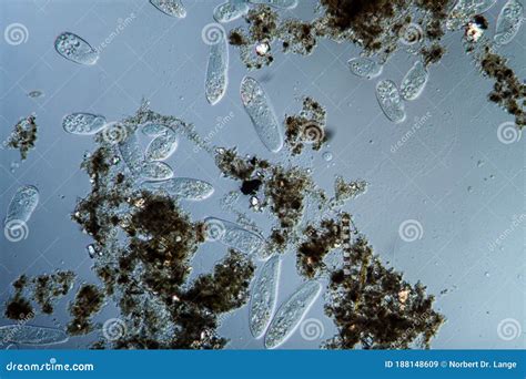 Plankton With Microscopic Ciliates Stock Image Image Of Plankton
