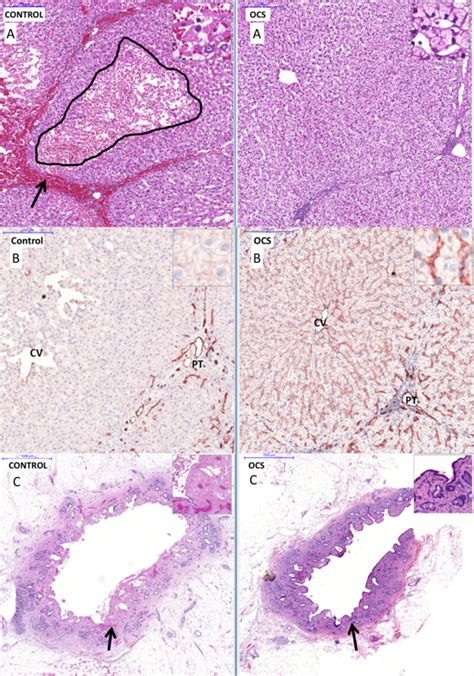 36 Hours Of Ex Vivo Warm Cellular Perfusion Of Swine Liver Using The