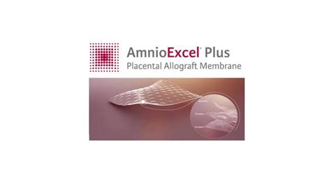 Integra Lifesciences Launches Amnioexcel Plus Placental Allograft