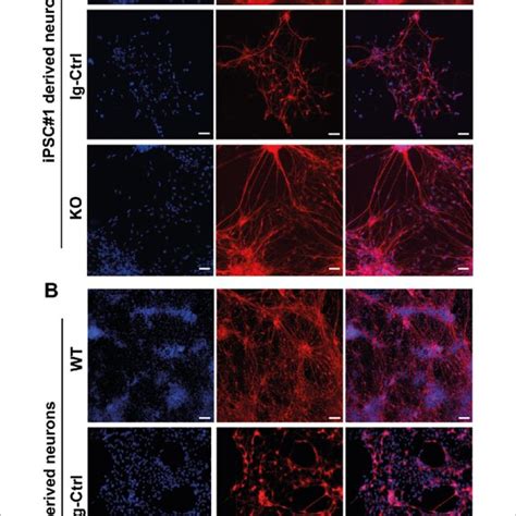 ß Iii Tubulin Stainings Of Ipsc Derived Neurons A Cells Derived From