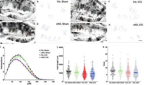 The Morphology Of Golgi Cox Stained Neurons In The Hippocampus Mice