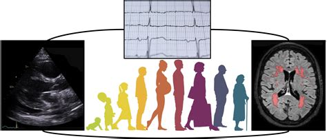 Towards A Better Understanding Of Cardio And Cerebrovascular Diseases UCL EPSRC Centre For