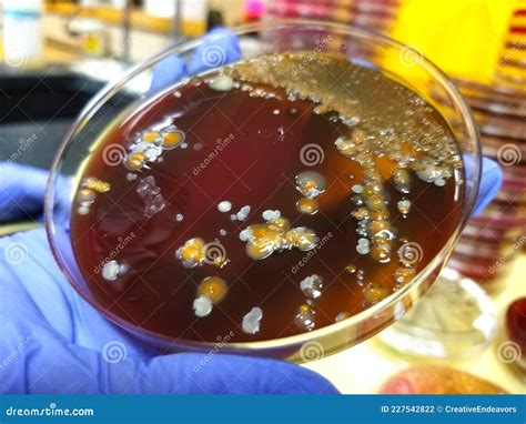Sphingomonas E Coli Propionibacteria And Streptococcus On Chocolate