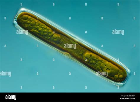 Differential Interference Contrast Hi Res Stock Photography And Images Alamy