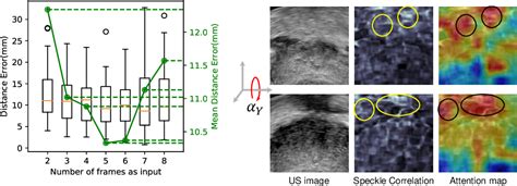 sensorless freehand 3d ultrasound reconstruction via deep contextual