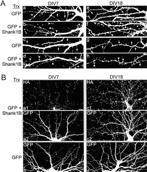 Figure 1 From Regulation Of Dendritic Spine Morphology And Synaptic Function By Shank And Homer