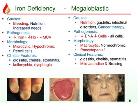 Ppt Anemia2 Deficiency Anemias Powerpoint Presentation Free Download